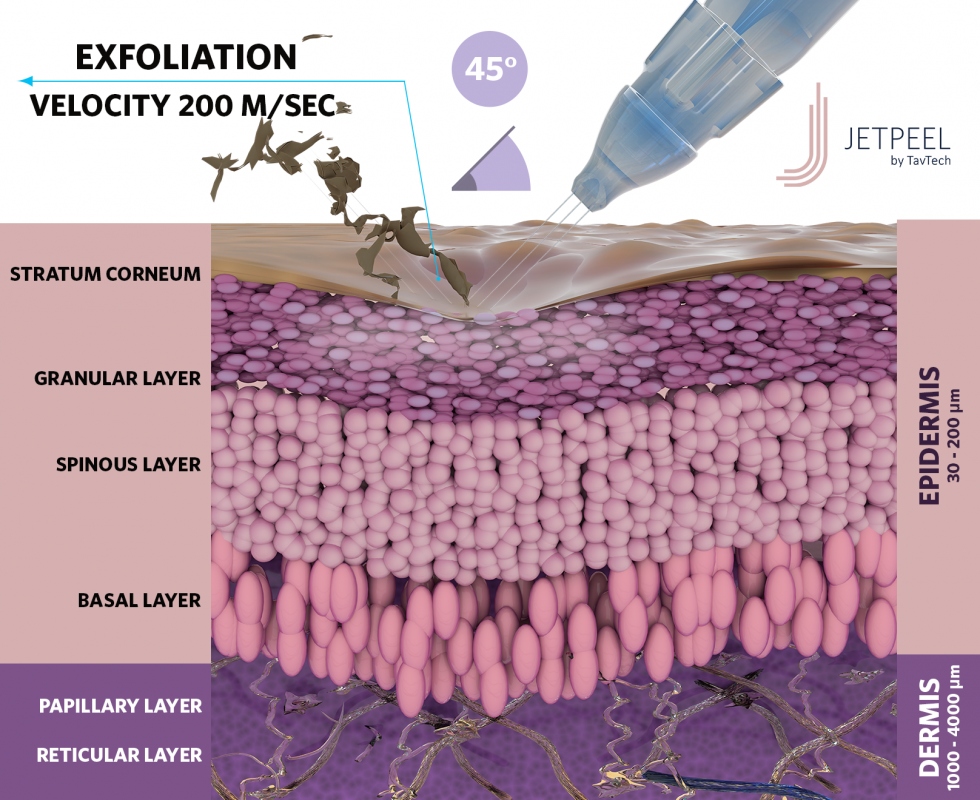 Jet Pressure Energy And Aesthetic Treatment Device Technology | JetPeel