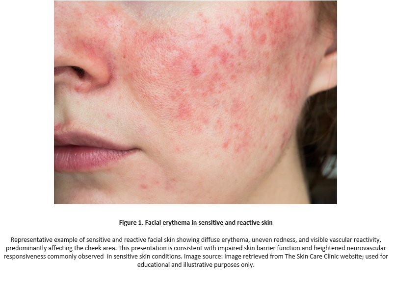 Sensitive Skin | Non Invasive Facial Treatments | JetPeel